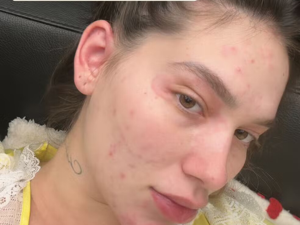 Virginia Pimenta da Fonseca Serrão Costa volta ao hospital horas após ...