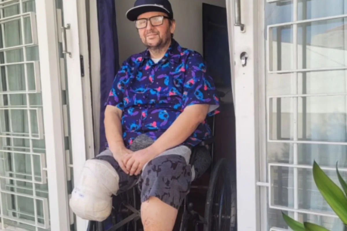 Por que David Castilho, de A Praça É Nossa, teve de amputar a perna?