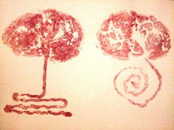 Você encararia? Alagoanos revelam motivos que os levam a comer placenta ...